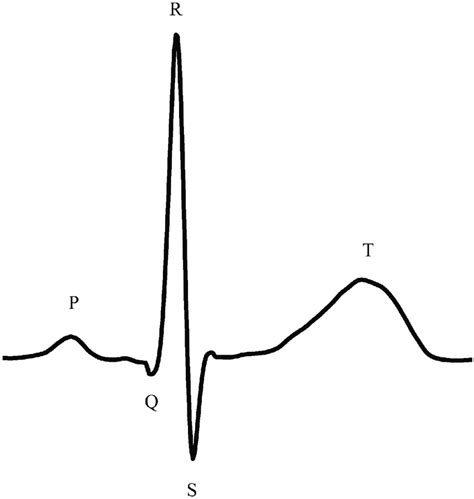 Schematic Ecg Waveform Of A Normal Cardiac Cycle Download Scientific Diagram