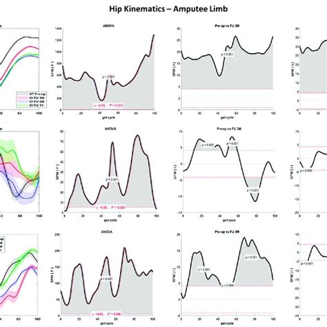 Hip Joint Kinematics For The Amputee Limb Over The Percentage Of The Download Scientific