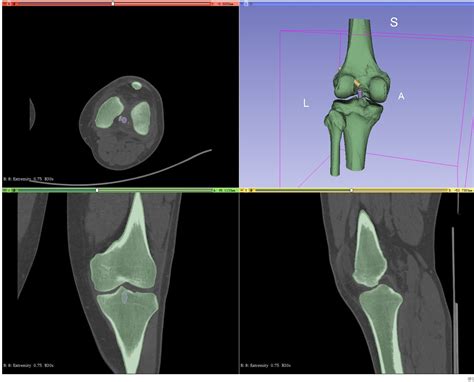 又好用的mpr么？slicer默认界面，一点都不好用 问题求助 3dslicer中文论坛