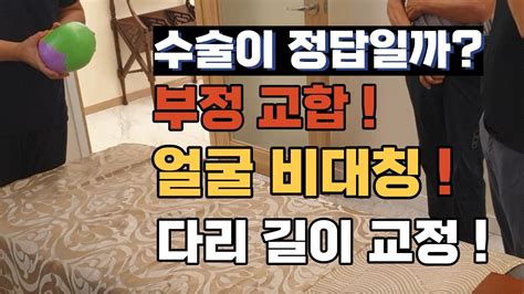 부정교합 치아교정 얼굴비대칭 수술 전에 몸부터 교정하자 Youtube