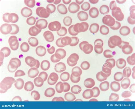 Analyzing Abnormal Cell Structures And Tissues Using Advanced Microscopy Techniques For