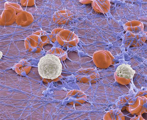 Picc Line Internal Surface Sem Stock Image C057 5304 Science Photo Library