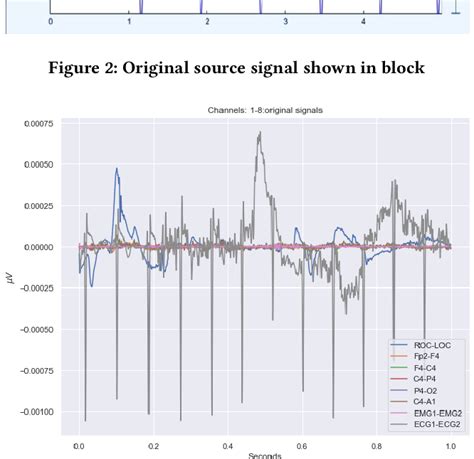 Figure 3 From Insomnia Eeg Signal Preprocessing Using Ica Algorithms Semantic Scholar