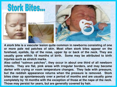Ppt Neonatal Evaluation And Care Immediate Measures After Birth
