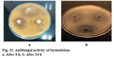 Development And Evaluation Of Microsphere Based Topical Formulation Using Design Of Experiments