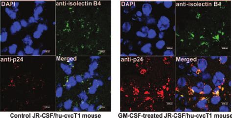 Systemic GM CSF Increases HIV Production In The Brains Of Download Scientific Diagram
