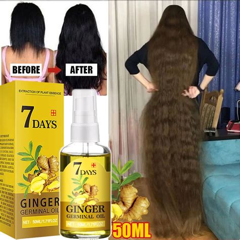 생강 모발 성장 제품 빠른 성장 헤어 에센셜 오일 뷰티 헤어 케어 탈모 방지 오일 두피 트리트먼트 남성 여성용