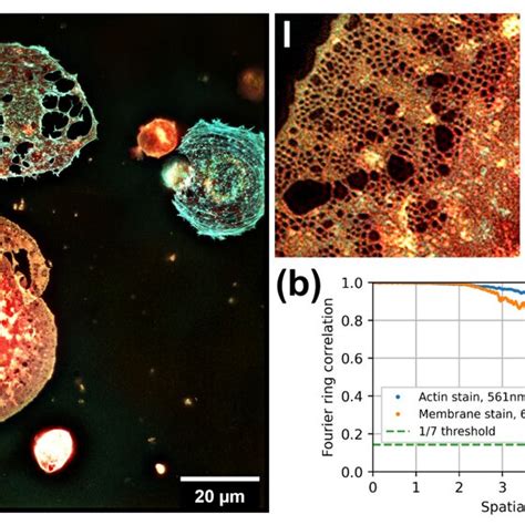 A Multicolor 2d Sim Image Of Fixed Lsecs Stained With Phalloidin
