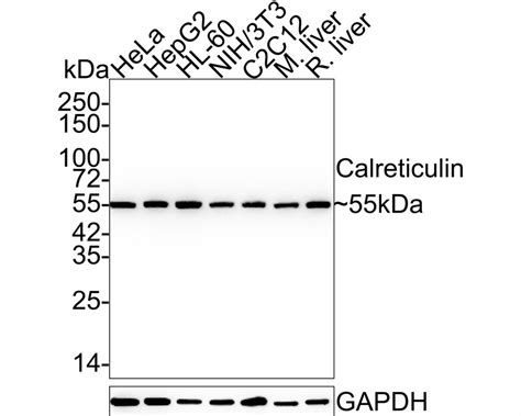 Calreticulin Recombinant Rabbit Monoclonal Antibody Su37 03 Et1608