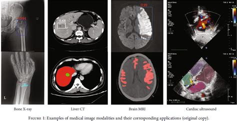 Advances In Deep Learning Based Medical Image Analysis By Khushil