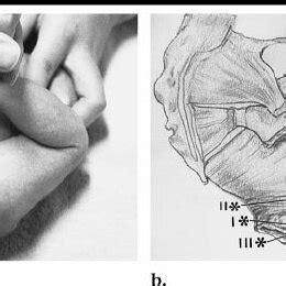 A Photograph Demonstrates Placement Of The Linear Transducer T Download Scientific Diagram