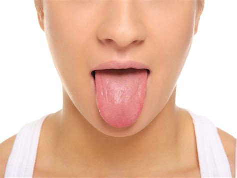 Dry Mouth 10 Causes Of Dry Mouth