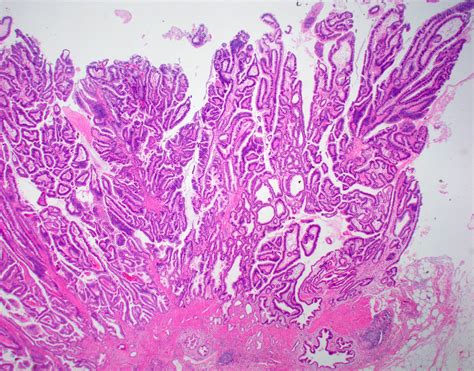 Gallbladder Histology Labeled