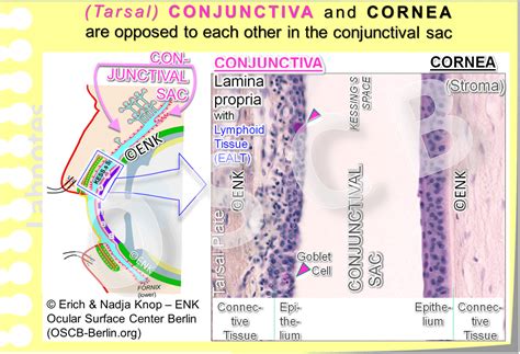 The Conjunctiva — Ocular Surface Center Berlin