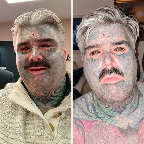 Total Stupidity Man Who Got His Eyeballs Tattooed Reveals Dangerous