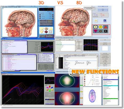 9d Nls Vector Nls Nls Vector Vector Nls Scan Vector Nls Device 9d Nls