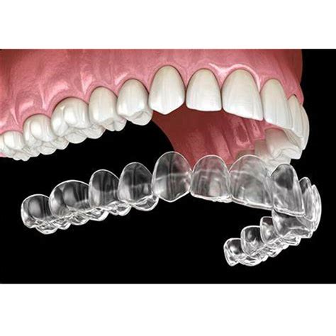 실리콘 젤 치아 교정기 구강 위생 치아 교정 기구 치아 리테이너 교정기 치료 정렬 장비 도구 구강 위생