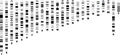 Human Chromosomes Depicted With Highly Accurate Staining Patterns Data