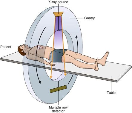 Ct Scanner Schematic