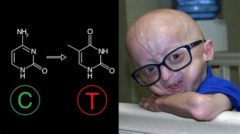 Base Editing Successfully Treats Progeria In Mice Youtube