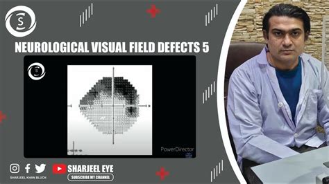Neurological Visual Field Defect