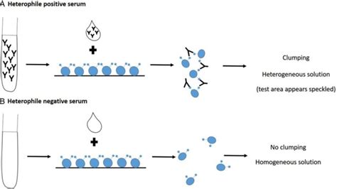 Monospot Test Principle Procedure Uses Microbe Online
