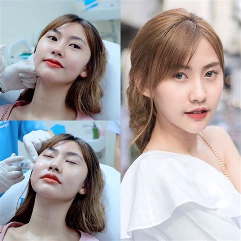ไม่ปังยังไงไหว วีขนาดนี้ Lbc Clinic เลอบิวทิส