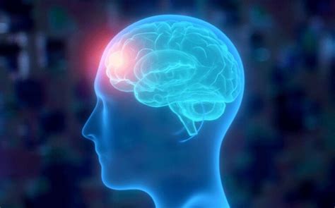 Enlarged Perivascular Spaces Revealed By Mri In Migraine Sufferers Hospital Healthcare Europe