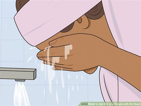 Ways To Get Rid Of A Pimple With No Head WikiHow