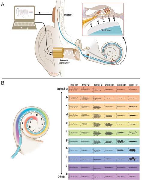 Cochlea Function What Is Deafness Main Types Of Deafness