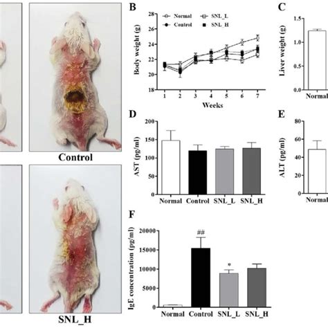 Experimental Procedure Of The Model Of Dncb Induced Atopic Dermatitis