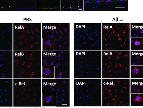 Rel Protein Translocation In Rpe Choroid Complexes And In Primary Mouse Download High