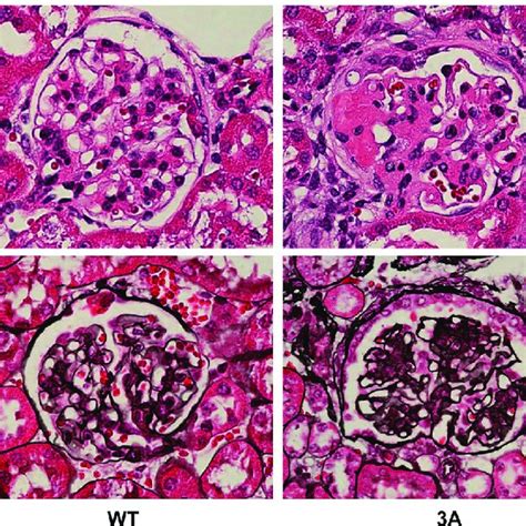 Transmission Electron Microscopy Of Glomeruli Of Wild Type Wt Left