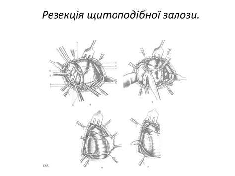 Топографічна анатомія шиї презентация онлайн