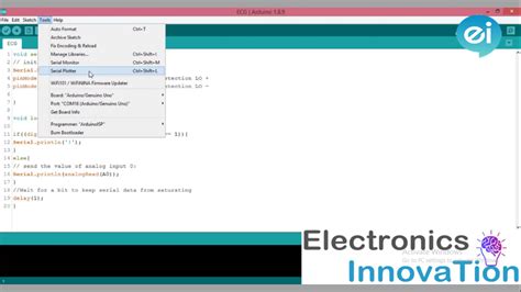 Low Cost Ad8232 Based Ecg And Heart Monitoring System Using Arduino Electronics Innovation