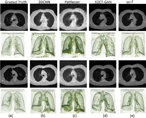 Spatially Consistent Implicit Volumetric Function For Uni And Bi Planar X Ray Based Computed