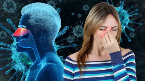 Sinusitis Así Puedes Eliminar Esta Enfermedad Según Expertos Posta