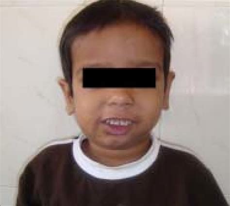 Extraoral Photograph Download Scientific Diagram