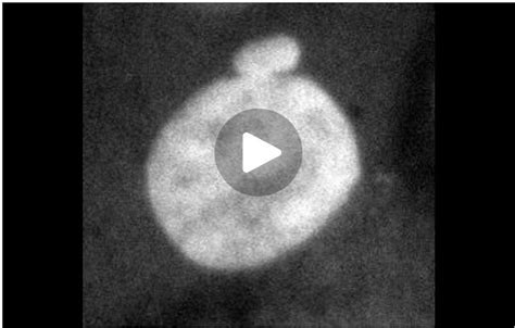 From Mboc We Show That Action Contraction Determines Nuclear Blebbing Bleb Based Ruptures And