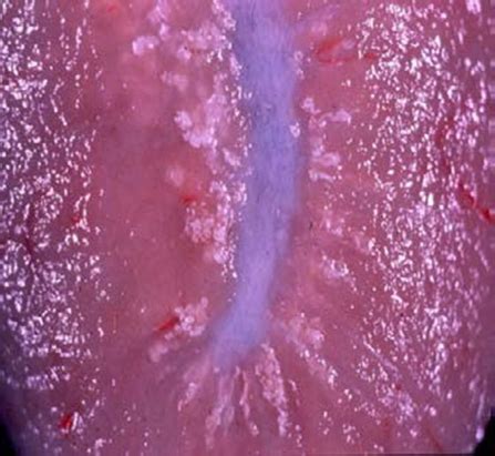 Male Repro Flashcards Quizlet