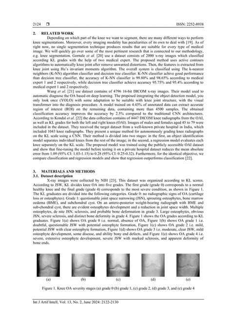 Knee Osteoarthritis Automatic Detection Using U Net Pdf