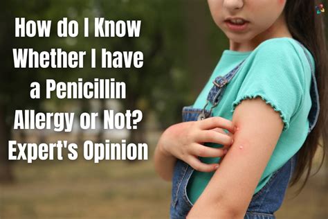How Do I Know Whether I Have A Penicillin Allergy Or Not Expert S Opinion The Lifesciences