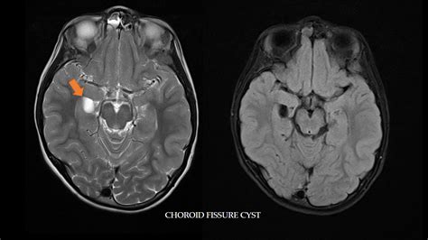 Ultimate Radiology December 2015