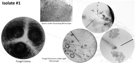 SOLVED Isolate Spores Under Dissecting Microscope Fungal Structures Under Light Microscope