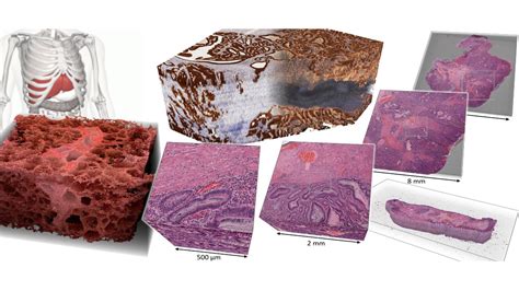 Inviwo Is A Software Framework For Rapid Visualization Prototyping 3d Hgistopathology