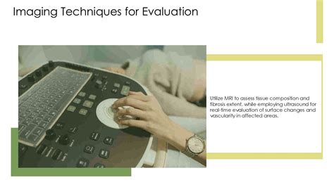 Hyalinized Fibrosis Ppt Graphics Acp Ppt Example