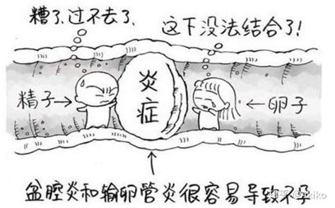 输卵管切除后还可以做试管婴儿吗？ 知乎