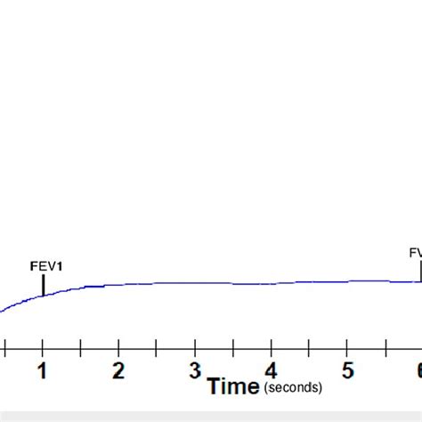 Volume Time Curve Showed A Proportional And Significant Decrease In The