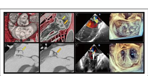 Ab Three Dimensional And Cd Cross Sectional Two Dimensional Download Scientific Diagram