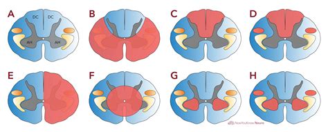 Spinal Cord And Spine Anatomy Review Chapter And Practice Questions